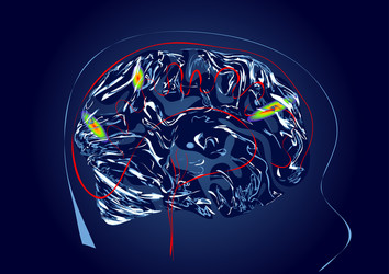 Scan Vector Images (over 91,000)