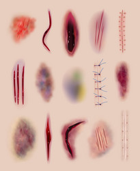 Realistic scars medical surgical sutures wounds Vector Image