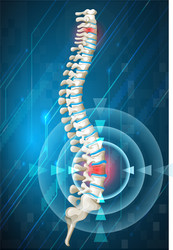 Spine bone showing back pain Royalty Free Vector Image