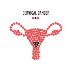 Cervical Cancer Vector Images (over 1,400)