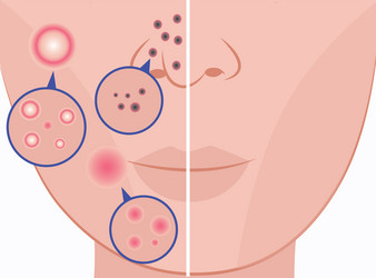 Scars Skin Vector Images (over 1,800)