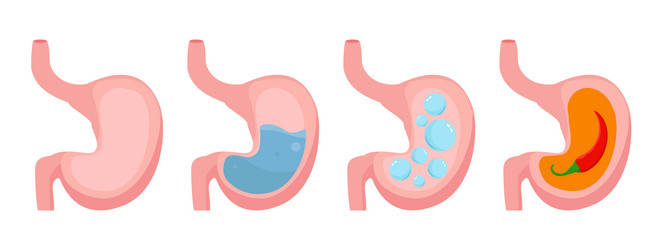 Human stomach empty and full bloating Royalty Free Vector