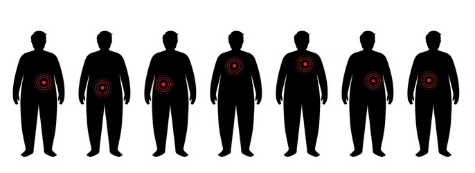 Organs in obese human body Royalty Free Vector Image