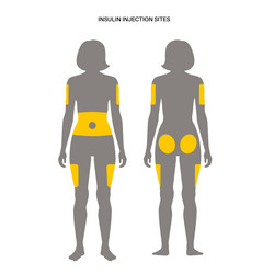 Insulin Injection Sites - Male Anatomy Royalty Free Vector
