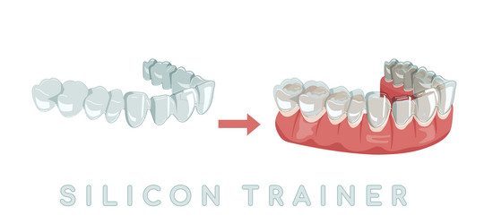 Orthodontic silicone trainer invisible braces Vector Image