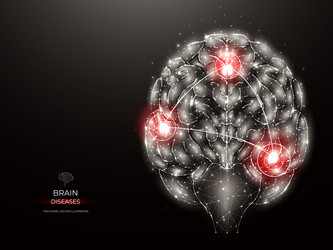 Polygonal of human brain inflammatory disease Vector Image