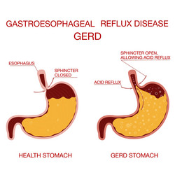 Gerd Vector Images (over 400)