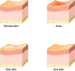 Skin Disorder Vector Images (over 1,000)