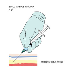 Subcutaneous Injection Vector Images (over 260)