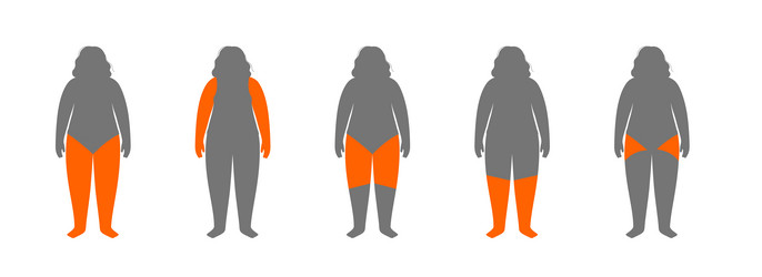 Overweight People Vector Images (over 7,000)