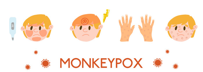 Monkeypox symptoms hand skin rashes blisters Vector Image