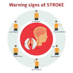 Ischemic stroke signs and symptoms - medical Vector Image
