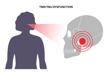 Tmd tmj disorder Royalty Free Vector Image - VectorStock