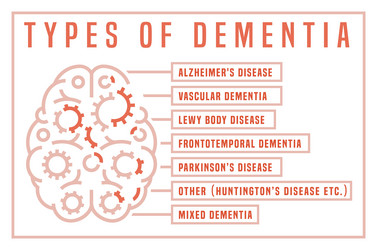 Dementia infographic in outline style Royalty Free Vector