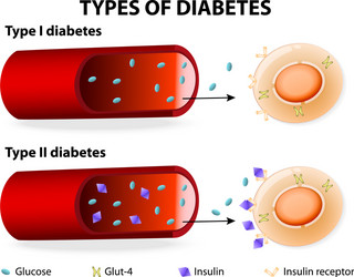 Diabetes disease health icons set Royalty Free Vector Image