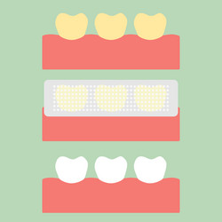 Teeth whitening strip Royalty Free Vector Image