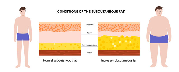 Subcutaneous fat level Royalty Free Vector Image