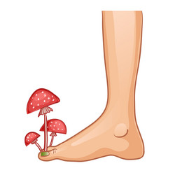 Fungal Infection Vector Images (over 610)