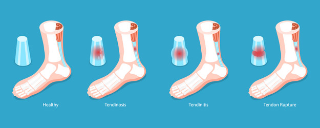 Stiffness Icon Vector Images (over 280)