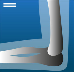 Bone Scan Vector Images (over 2,700)