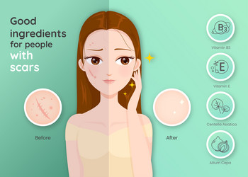 Skin scars and wounds surgery stitches horror Vector Image