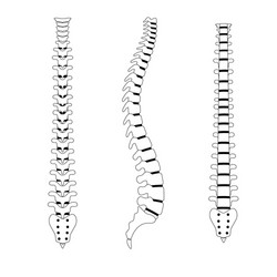 Types scoliosis c s z shaped Royalty Free Vector Image