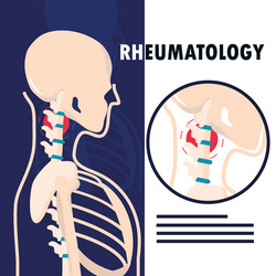 Rheumatology Vector Images (over 1,400)