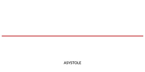 Ecg heartbeat line electrocardiogram normal Vector Image