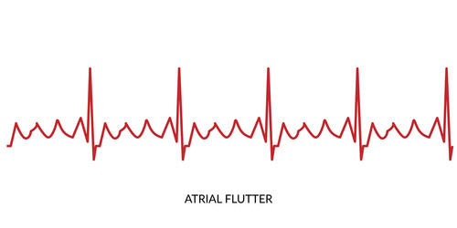 Ecg heartbeat line electrocardiogram normal Vector Image