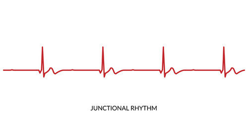 Ecg heartbeat line electrocardiogram atrial Vector Image