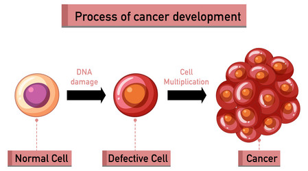 Process of cancer cell development Royalty Free Vector Image