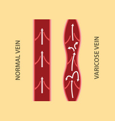 Venous system Royalty Free Vector Image - VectorStock