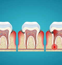 Caries Vector Images (over 3,400)