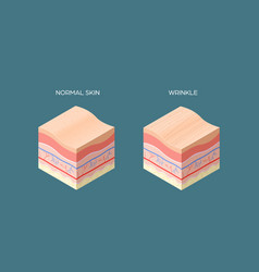 Set different types skin layers cross-section Vector Image