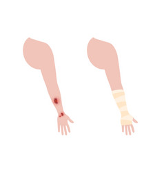 Human male arm left side Royalty Free Vector Image