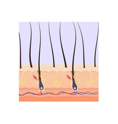 Types of split ends hair with scalp layer Vector Image