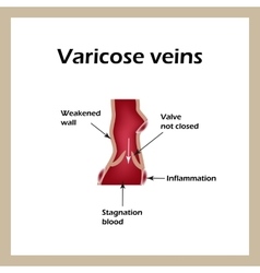 Venous system Vector Image by P6M5 - Image #826048 - VectorStock