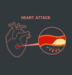 Heart disease symptoms logo icon Royalty Free Vector Image