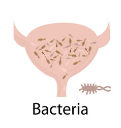 Informative urinary tract infections Royalty Free Vector