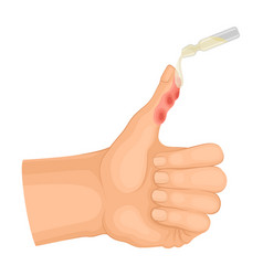 First aid for hand with ambustion or burn Vector Image