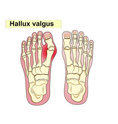Foot bones scheme human ankle anatomy body part Vector Image