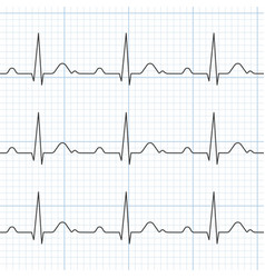 Heart rhythm set electrocardiogram ecg - ekg Vector Image