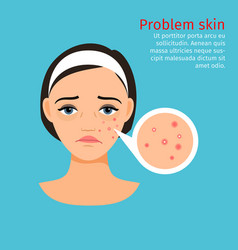 Female face with skin problems Royalty Free Vector Image