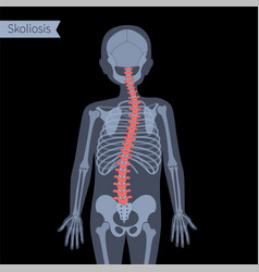 Spine x ray Royalty Free Vector Image - VectorStock