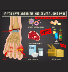 Gout arthritis infographic Royalty Free Vector Image