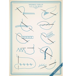 Surgical stitches infographic set Royalty Free Vector Image