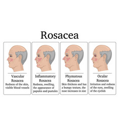 Diabetic foot Royalty Free Vector Image - VectorStock