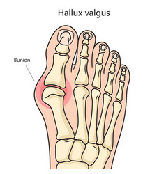 Pelvis bones structure diagram medical science Vector Image