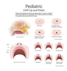Girl mouth animation expression pronunciation Vector Image